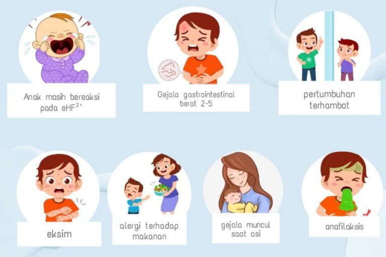 Red Flags Alergi Susu Sapi pada Anak