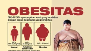 Mengenali Lebih Dalam tentang Obesitas